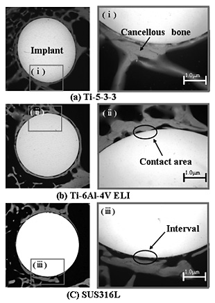 55.Mechanical Strength and Biocompatibility of Meta-Stable Beta Type Ti ...